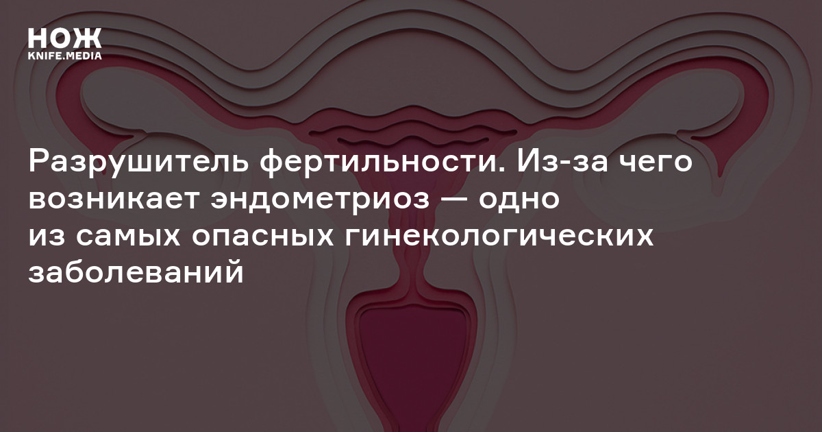 Эндометриоз — Нож
