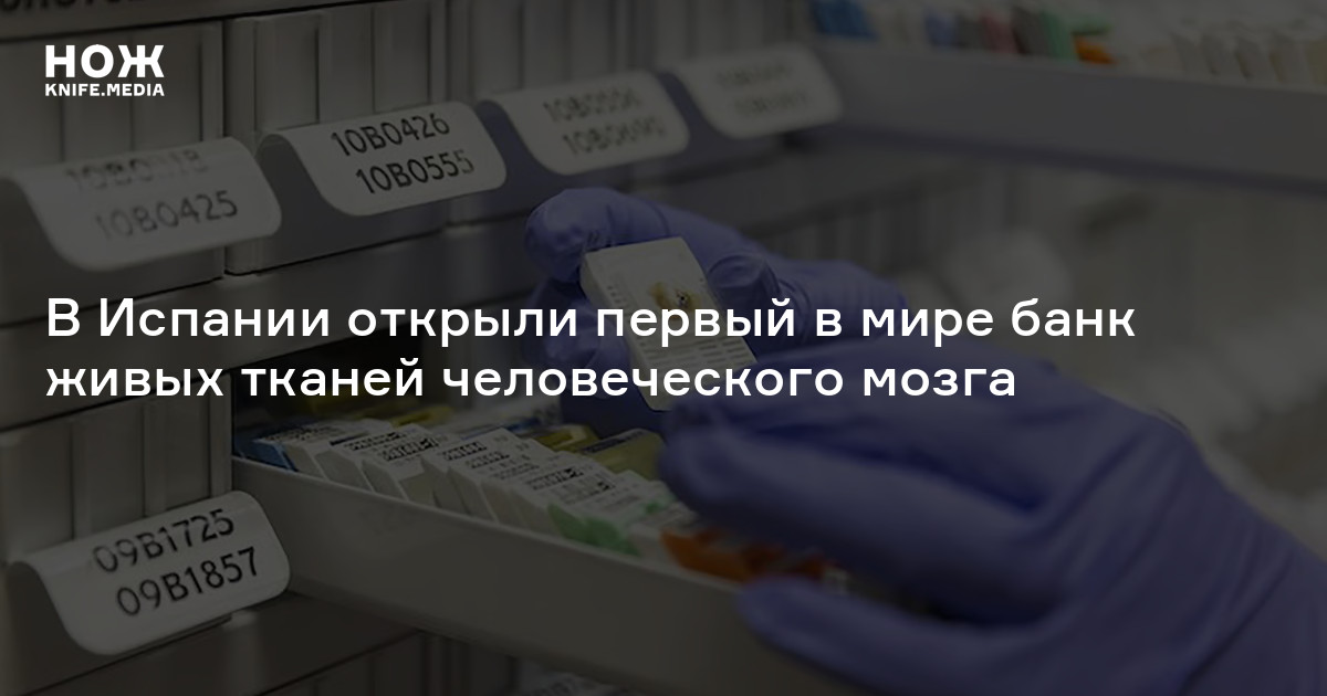 В Испании открыли первый в мире банк живых тканей человеческого мозга — Нож