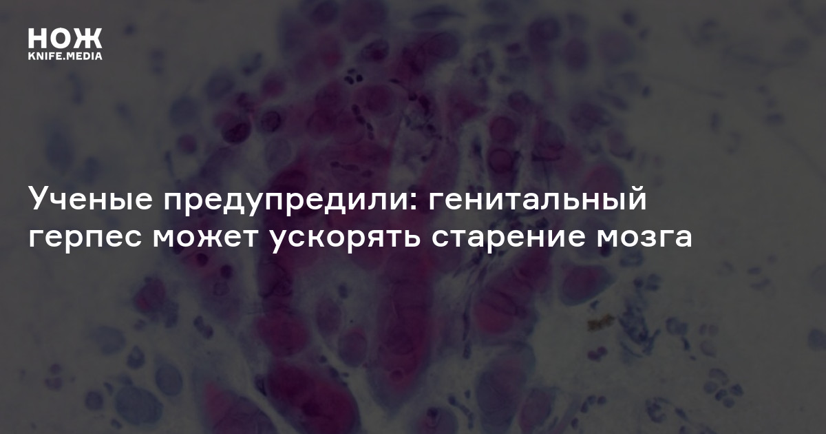 Ученые предупредили: генитальный герпес может ускорять старение мозга — Нож