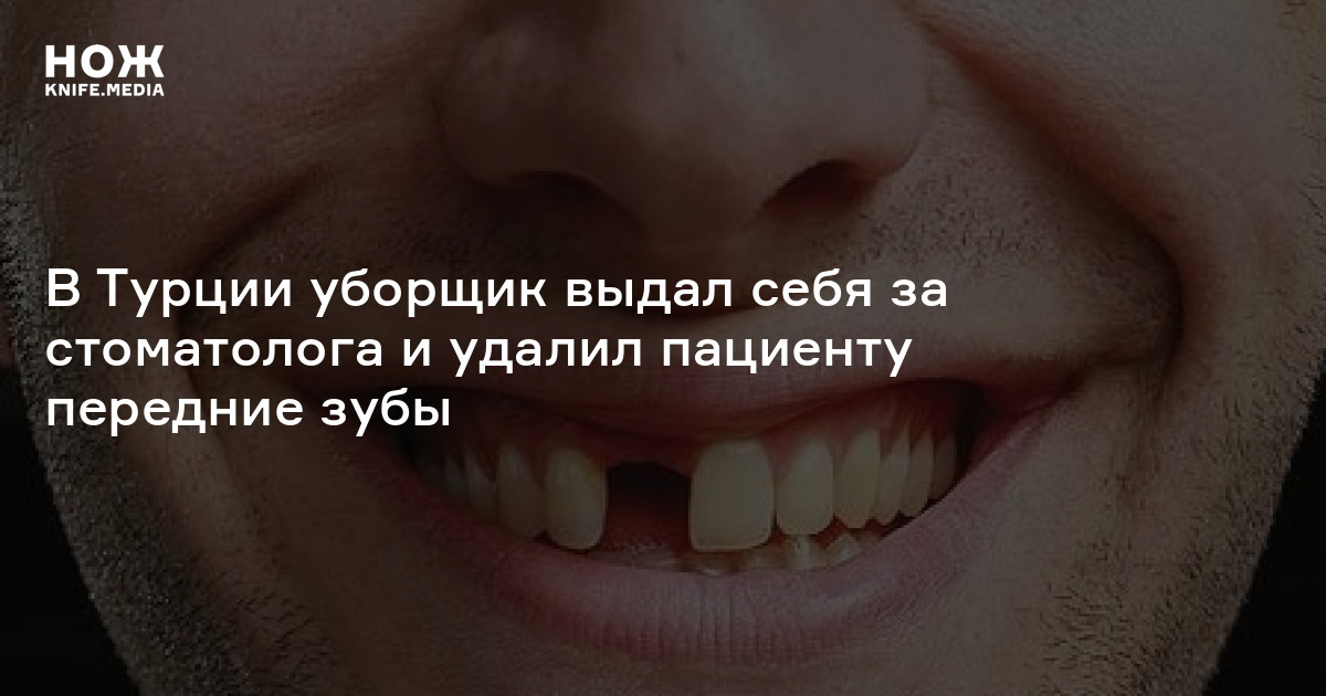В Турции уборщик выдал себя за стоматолога и удалил пациенту передние ...