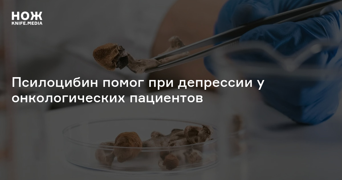 Псилоцибин помог при депрессии у онкологических пациентов — Нож