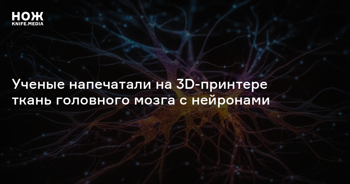 Ученые напечатали на 3d принтере ткань головного мозга с нейронами — Нож