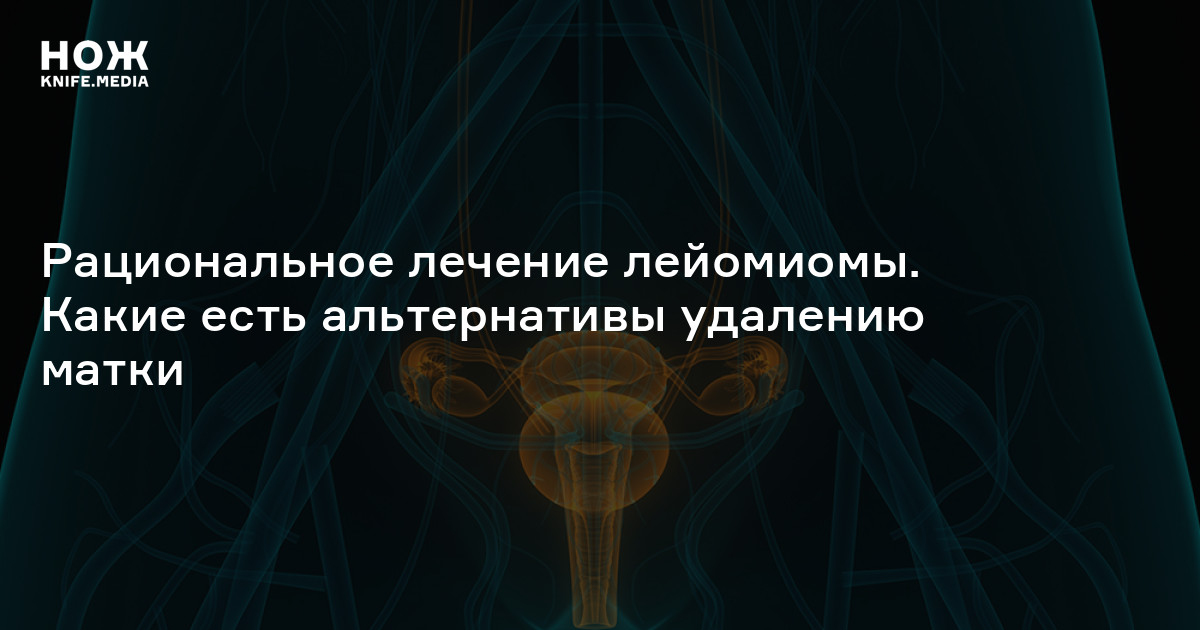 Миома матки — Нож